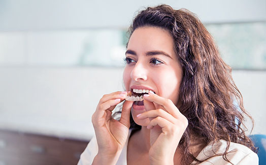 Invisalign® Clear Aligners in Woodbridge | Roysun Dental Centre