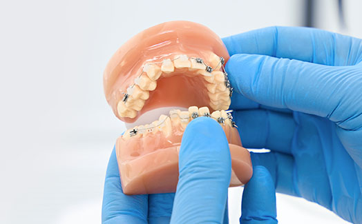 Orthodontics in Woodbridge | Roysun Dental Centre